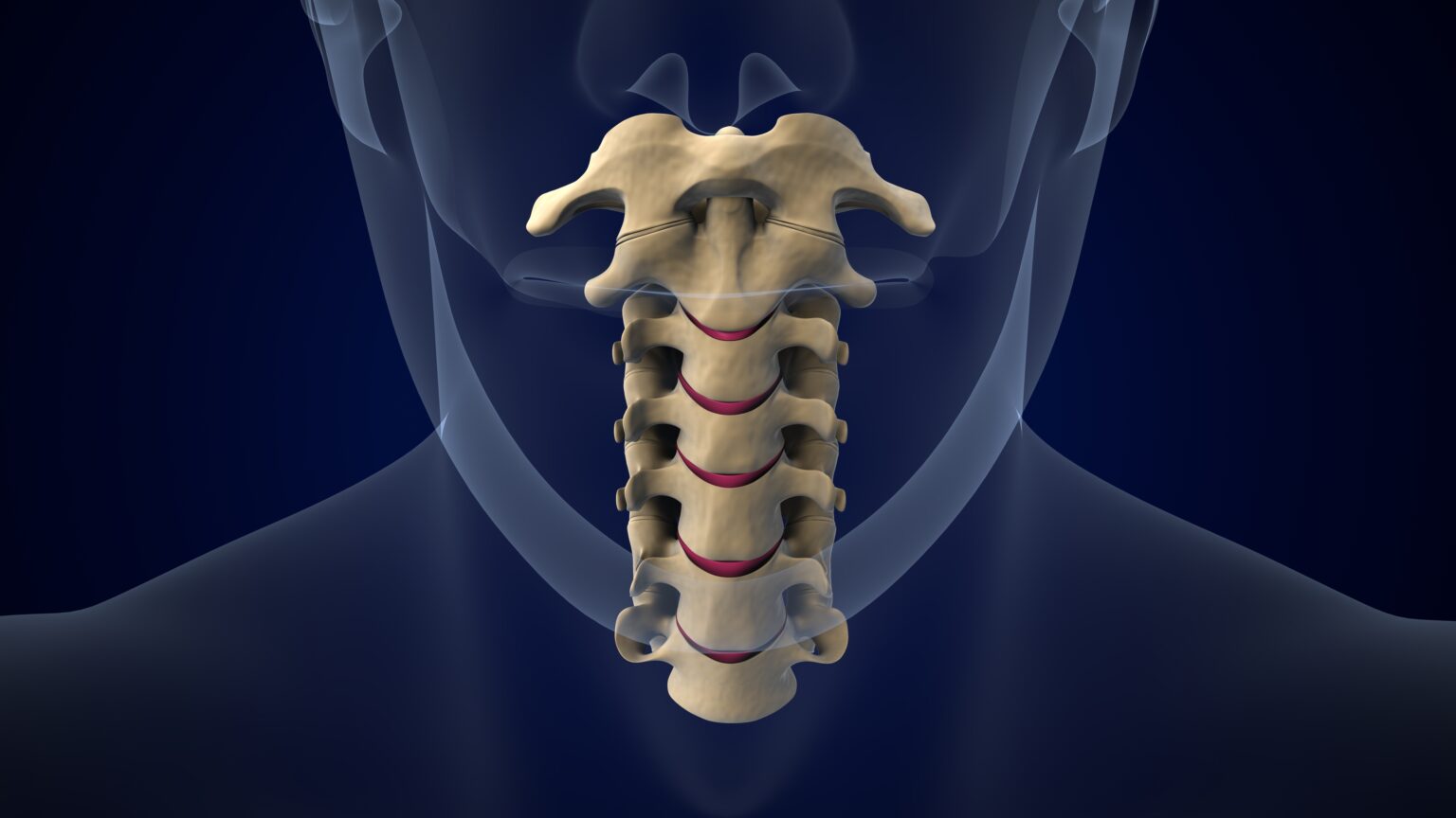 Anterior Cervical Discectomy and Fusion (ACDF) – Dr Gaurav M